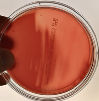 Comprendre la dysenterie porcine, une maladie redoutable